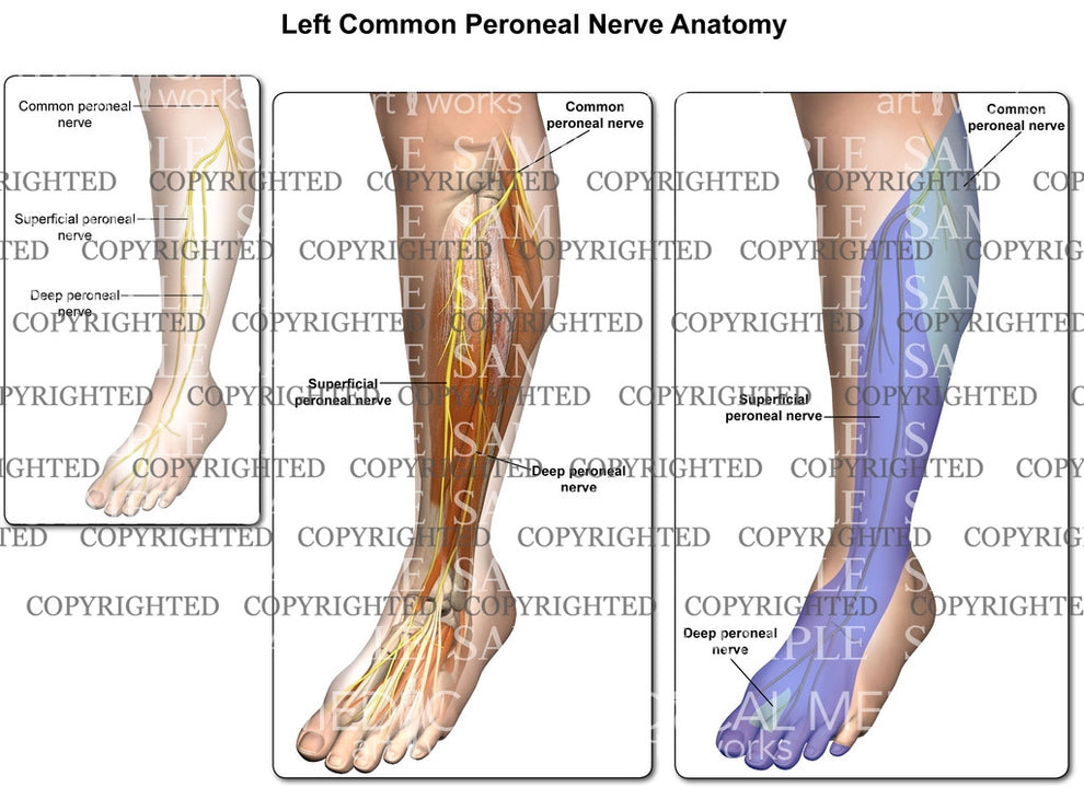 Left Common Peroneal Nerve Anatomy – Medical Art Works