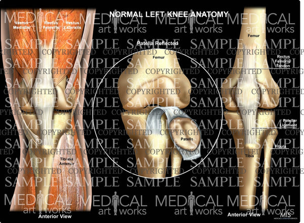 Normal Left Knee Anatomy 7 – Medical Art Works